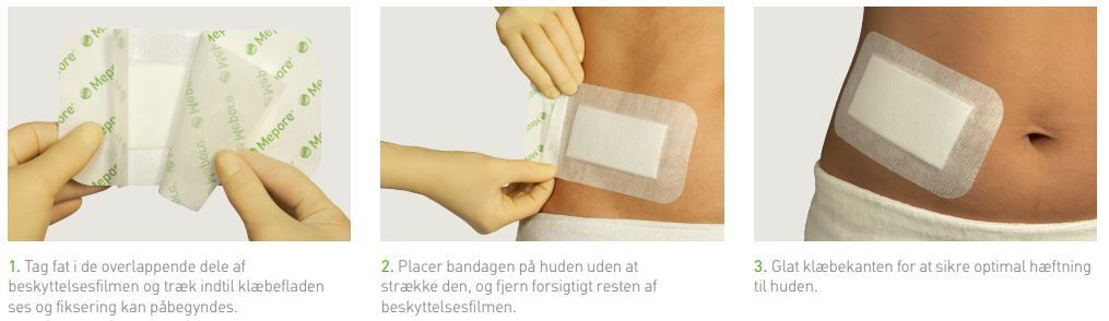 Køb Mepore plaster steril billigt hos Med24.dk